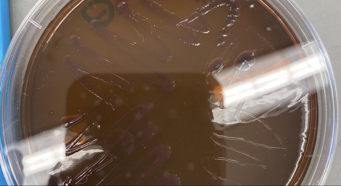 Solved What does this EMB plate result indicate? Positive or | Chegg.com