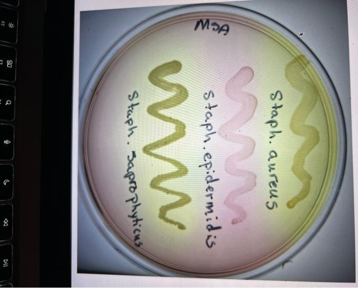 Solved Using only the info below, is my bacteria Staph. | Chegg.com