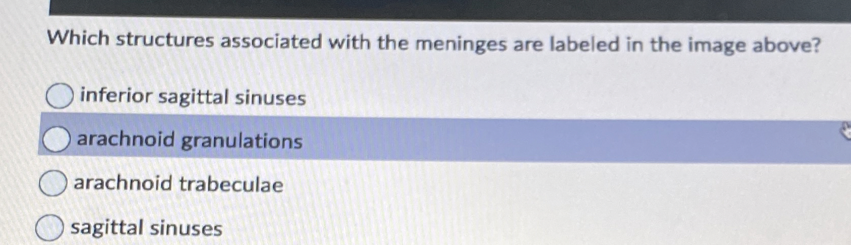 Solved Which structures associated with the meninges are | Chegg.com