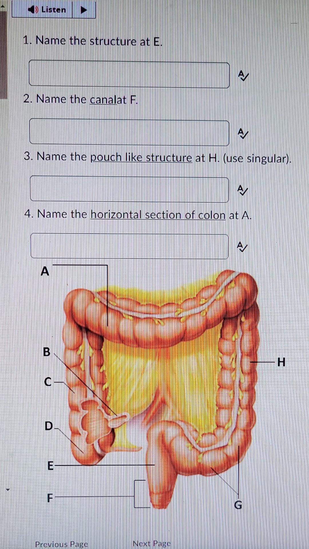 Solved 1. Name the structure at E. A 2. Name the canalat F. | Chegg.com