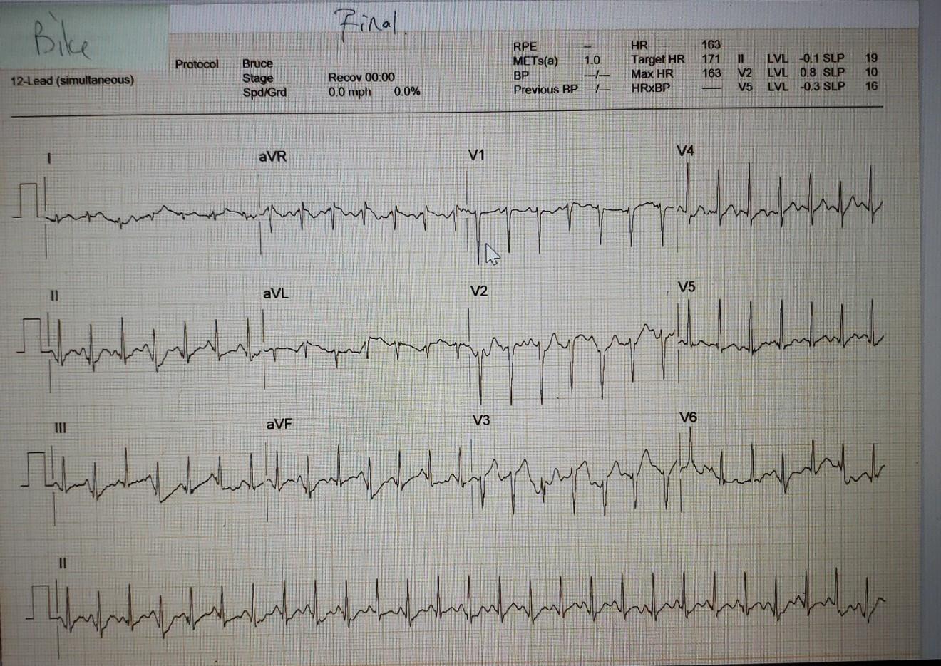 Solved Bike Final RPE Protocol METs(a) 1.0 HR Target HR Max | Chegg.com