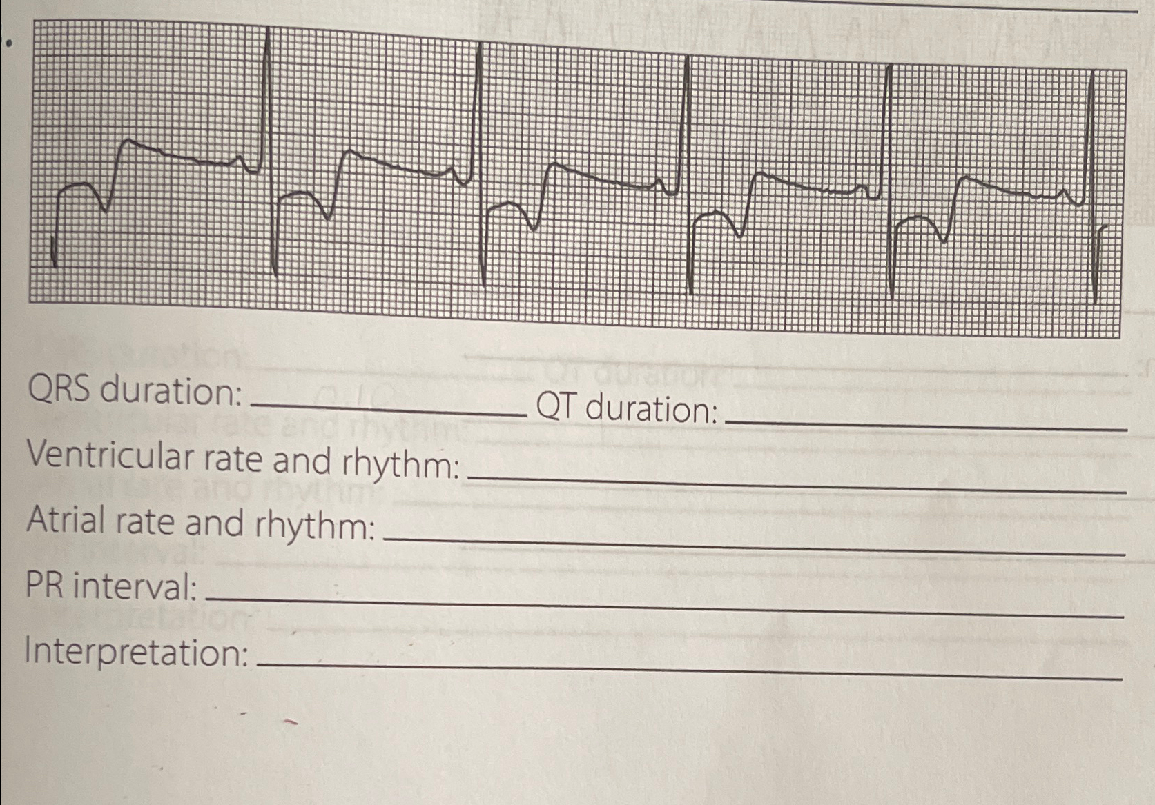 Solved QRS duration:QT duration:Ventricular rate and | Chegg.com