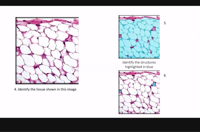 Solved 5 Identify the structures highlighted in blue 4. | Chegg.com