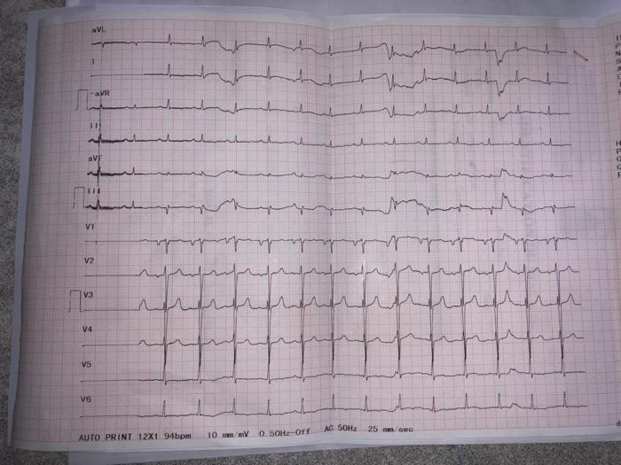 Solved please interpret the above results | Chegg.com