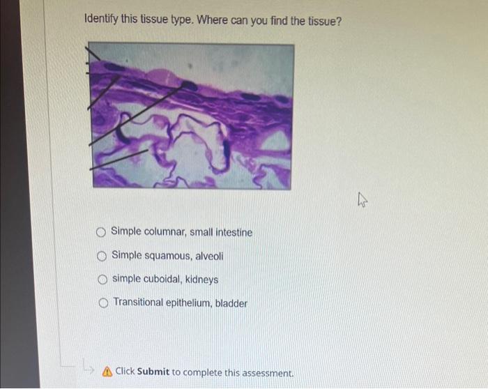 Solved Identify this tissue simple squamous stratified | Chegg.com