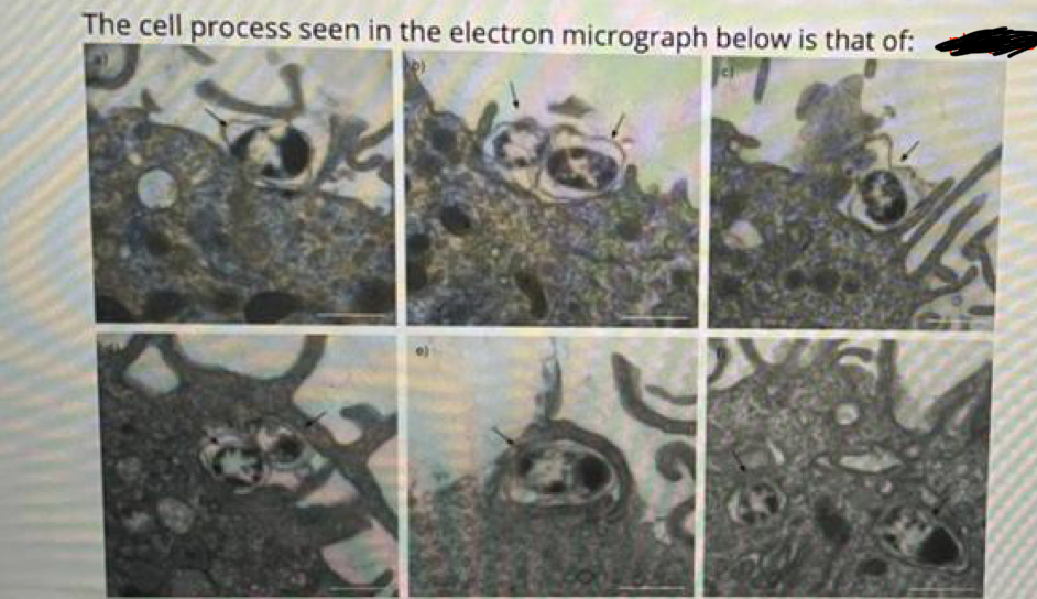 Solved The cell process seen in the electron micrograph | Chegg.com
