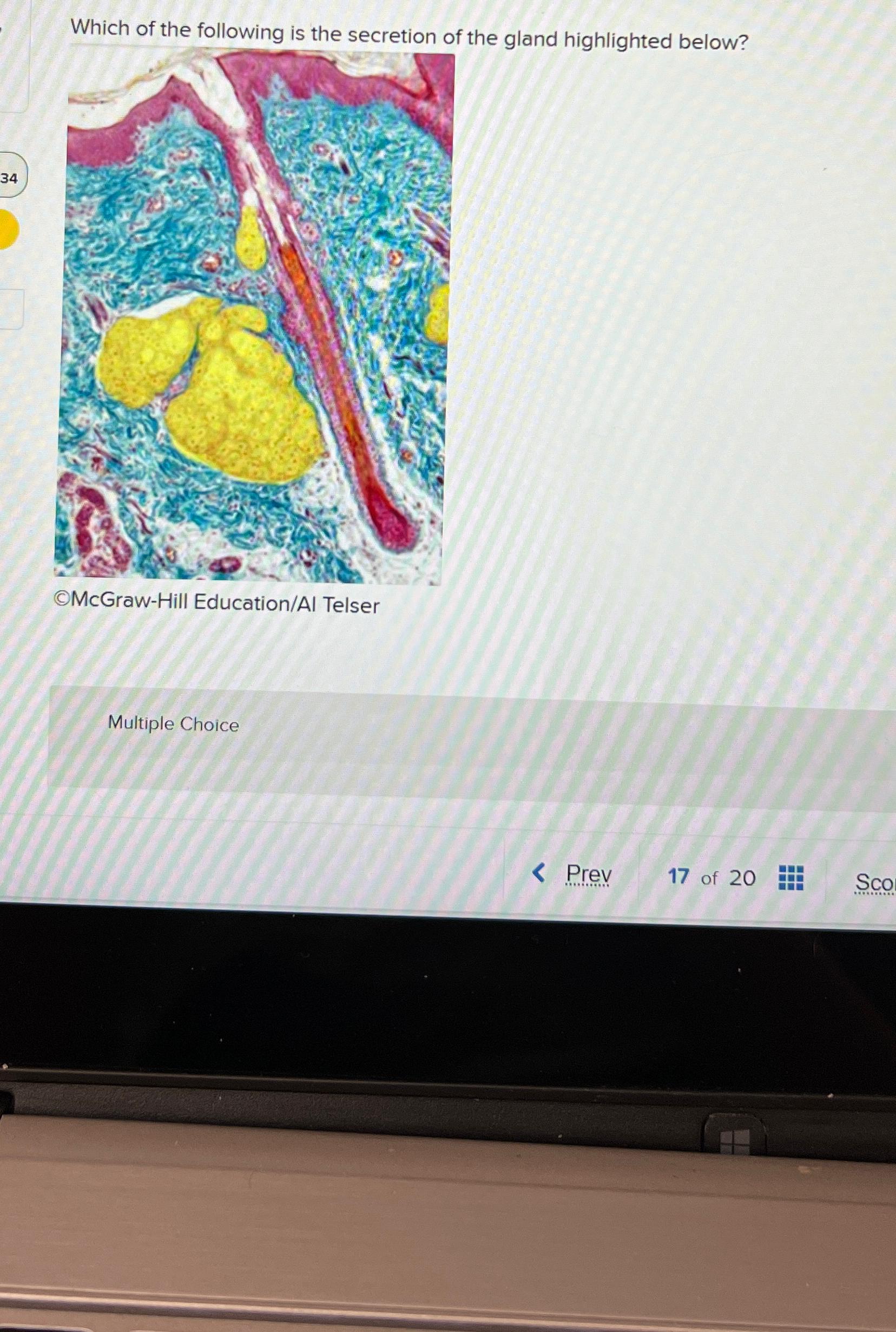 Solved Which of the following is the secretion of the gland | Chegg.com