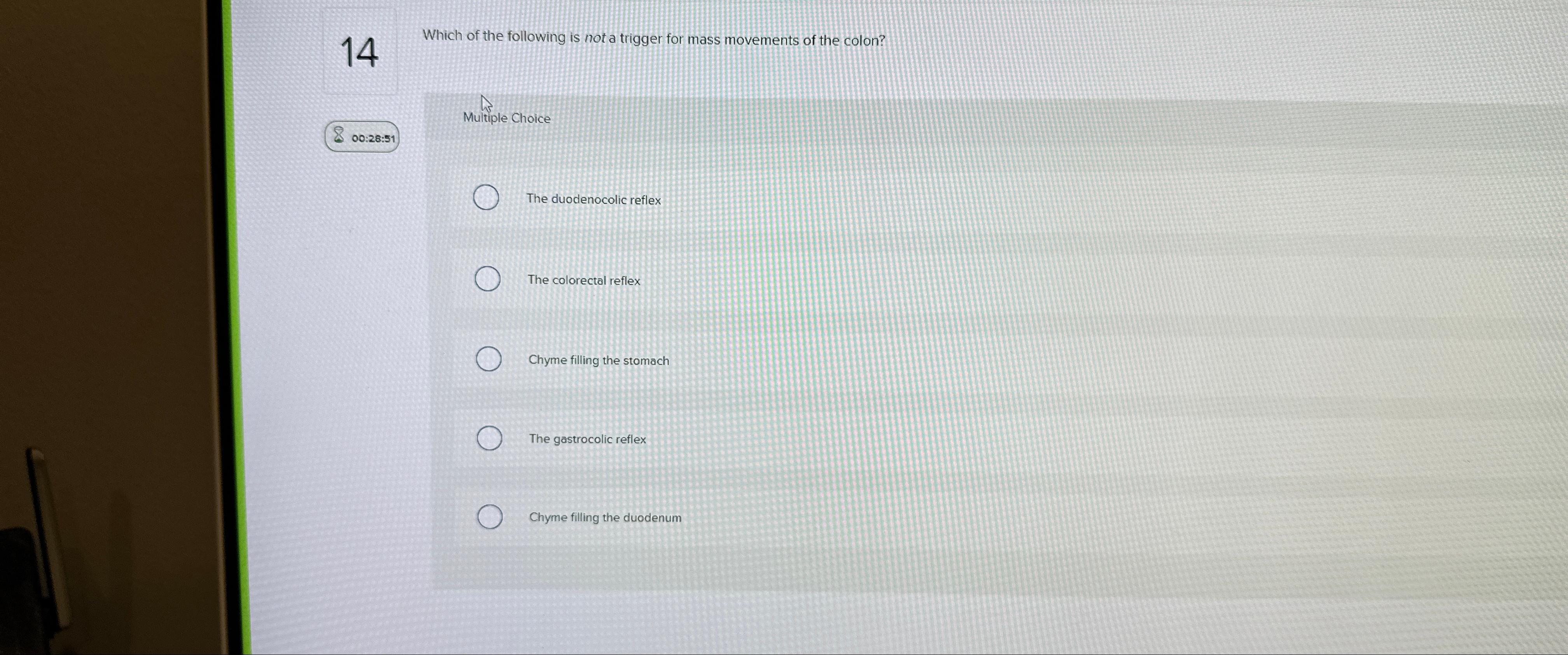 Solved 14Which of the following is not a trigger for mass | Chegg.com