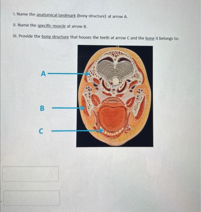 Solved i. Name the anatomical landmark (bony structure) at | Chegg.com