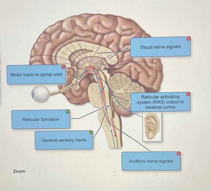 Solved Correctly label the following figure representing the | Chegg.com