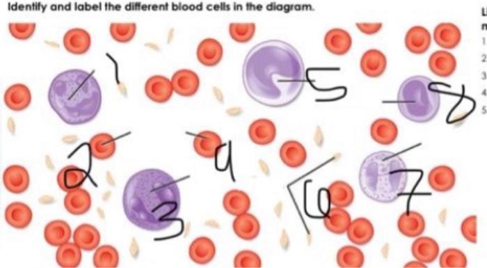 Solved Identify and label the different blood cells in the | Chegg.com