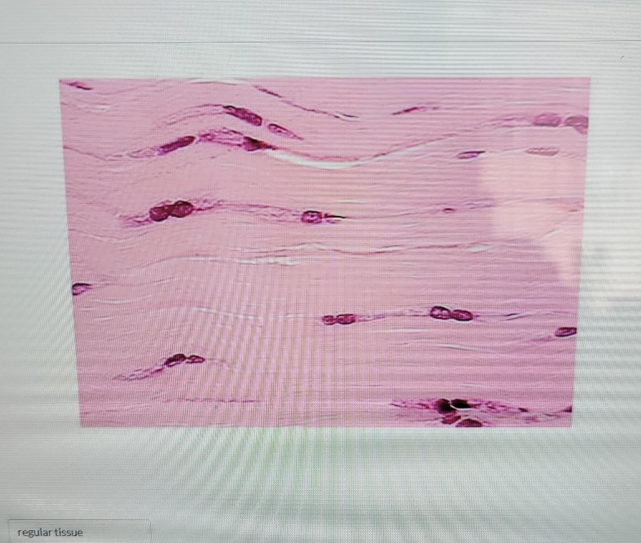 Solved sue. PRO fe regular tissue | Chegg.com