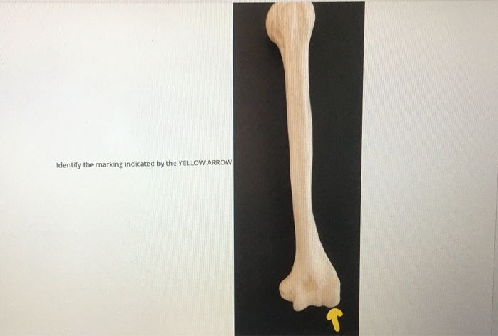 Solved Identify the marking indicated by the YELLOW ARROW | Chegg.com