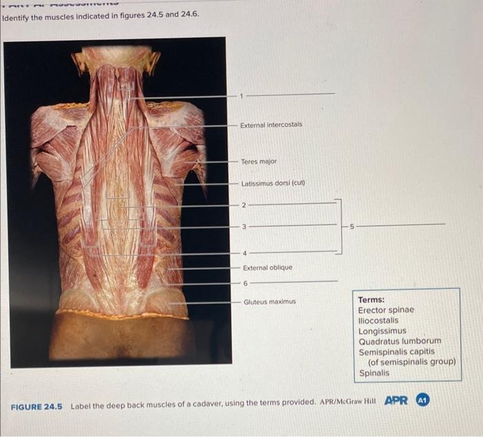 Identify the muscles indicated in figures 24.5 and | Chegg.com