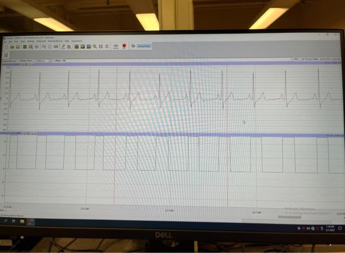 include image of the EKG with the waves labeled, | Chegg.com