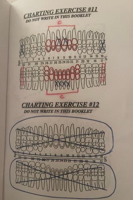CHARTING EXERCISE \#7 DO NOT WRITE IN THIS BOOKLET | Chegg.com