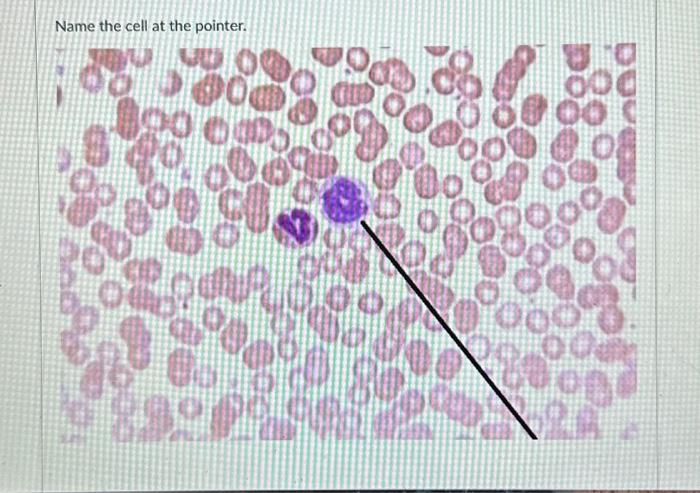 Solved Name the cell at the pointer eosinophil basophil | Chegg.com