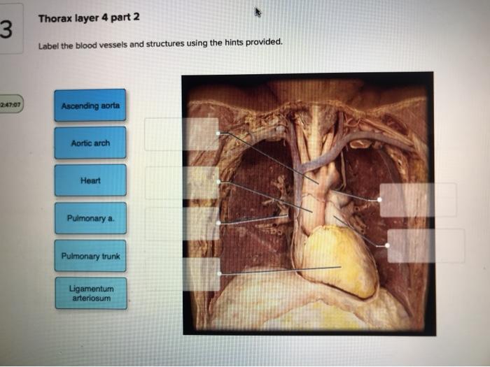 Solved Thorax layer 4 part 2 3 Label the blood vessels and | Chegg.com