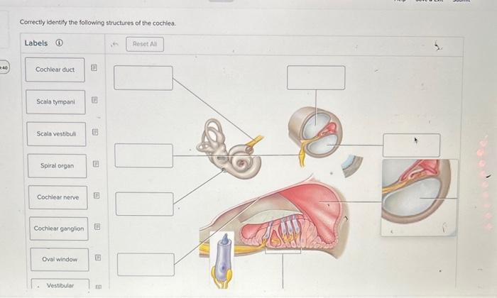 Solved Correctly identify the following structures of the | Chegg.com