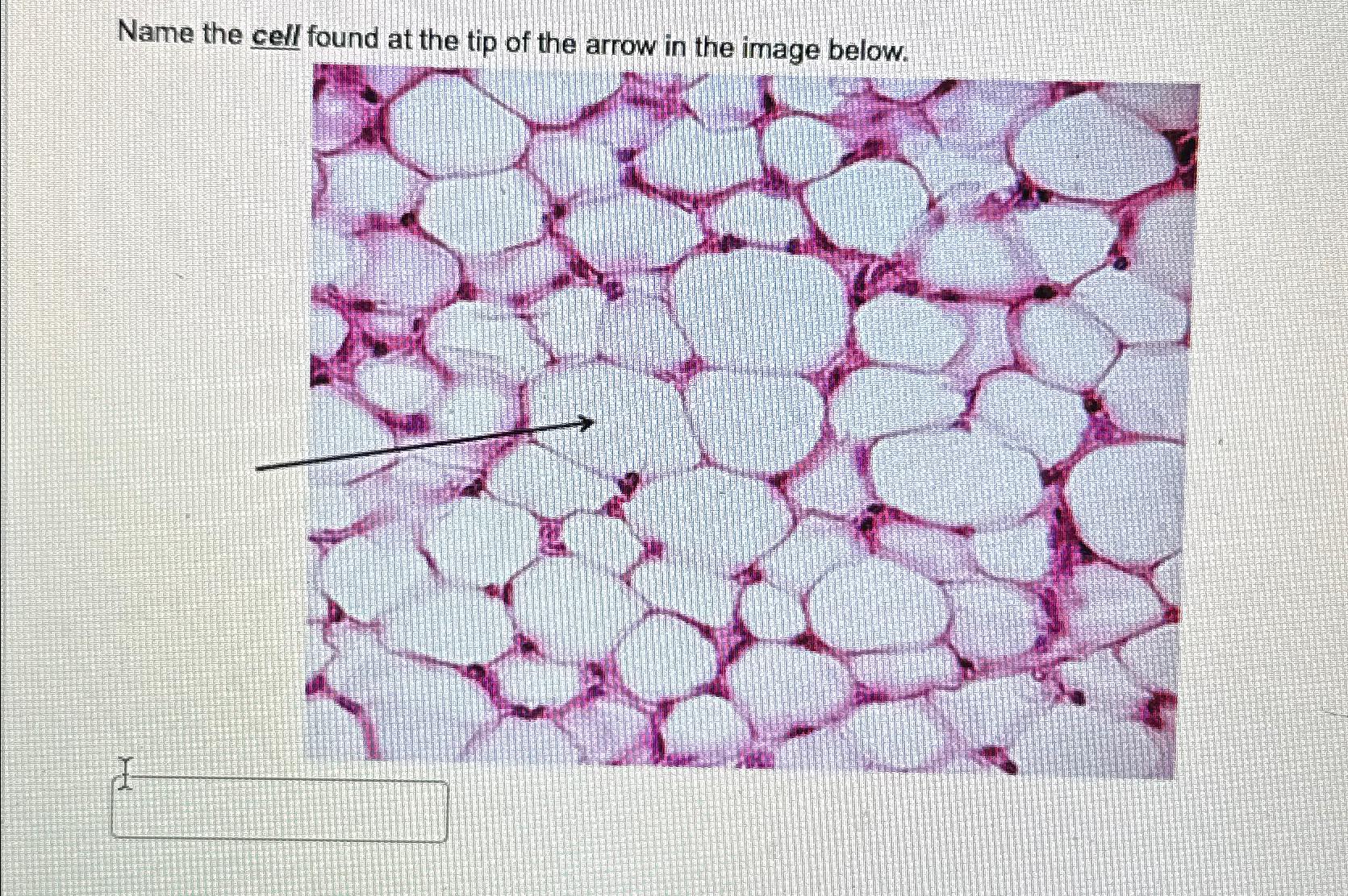 Solved Name the cell found at the tip of the arrow in the | Chegg.com