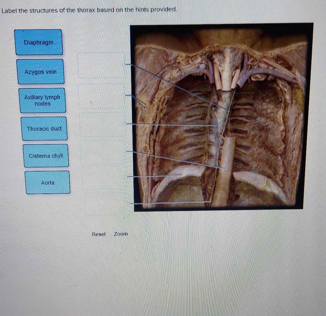 [Solved]: Label the structures of the tho