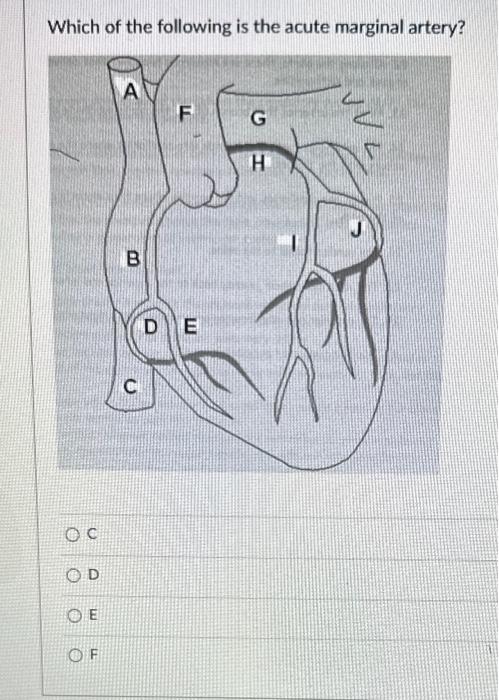 Solved Which of the following is the acute marginal artery? | Chegg.com