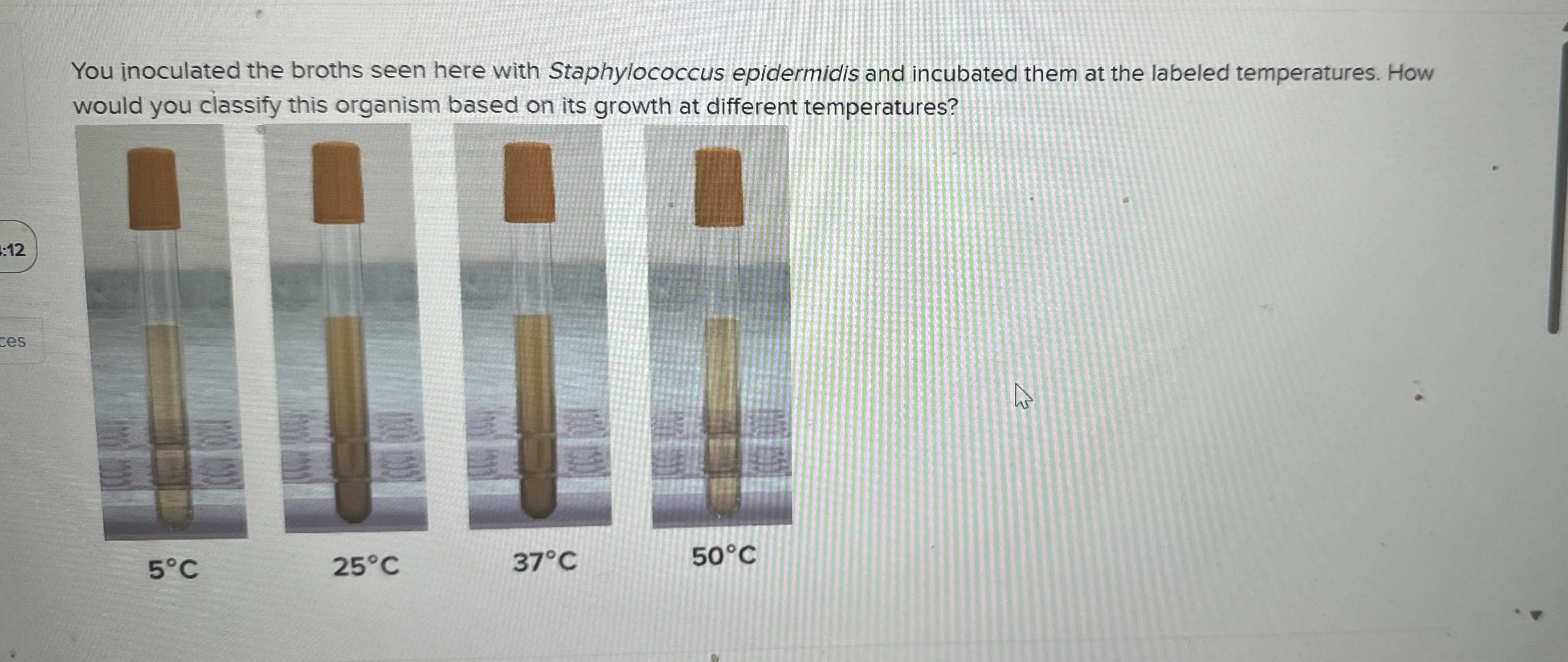 Solved You inoculated the broths seen here with | Chegg.com