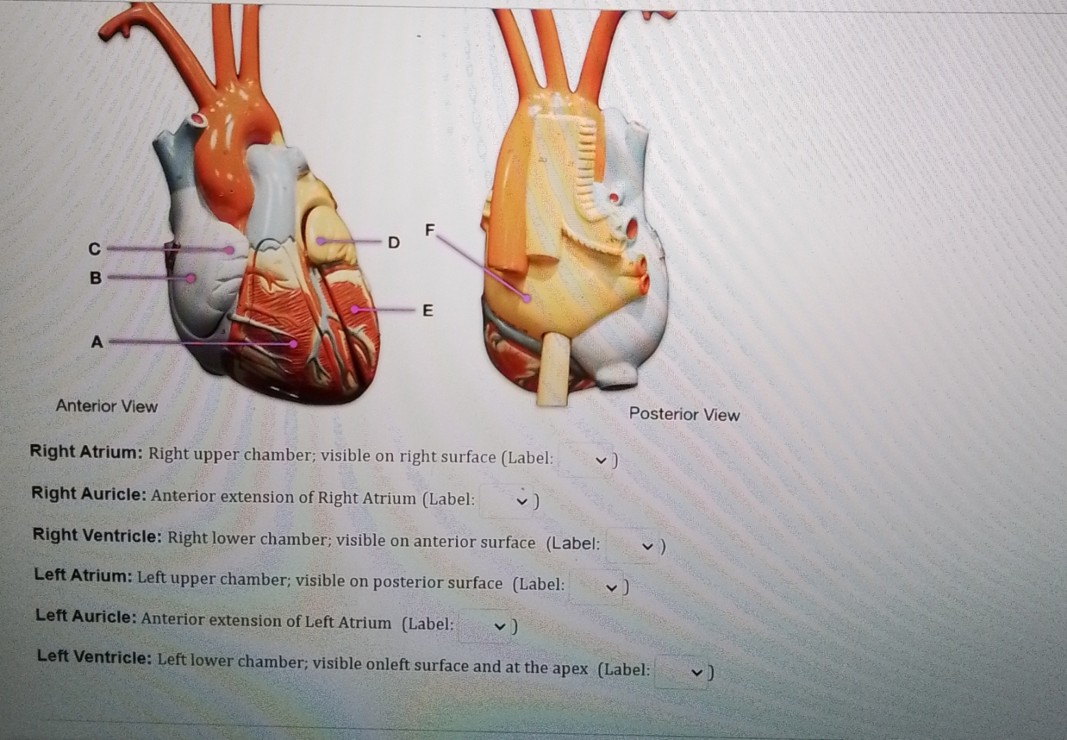 Solved Right Atrium: Right upper chamber; visible on right | Chegg.com