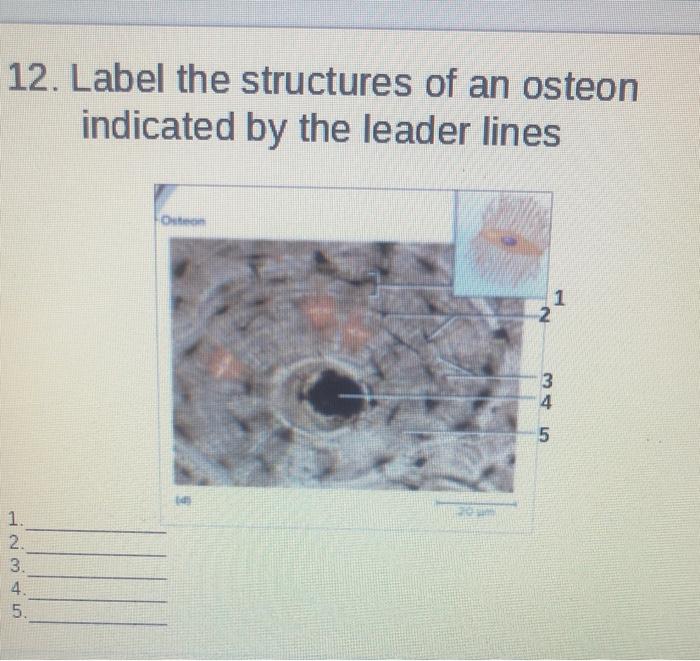 Solved 12. Label the structures of an osteon indicated by | Chegg.com