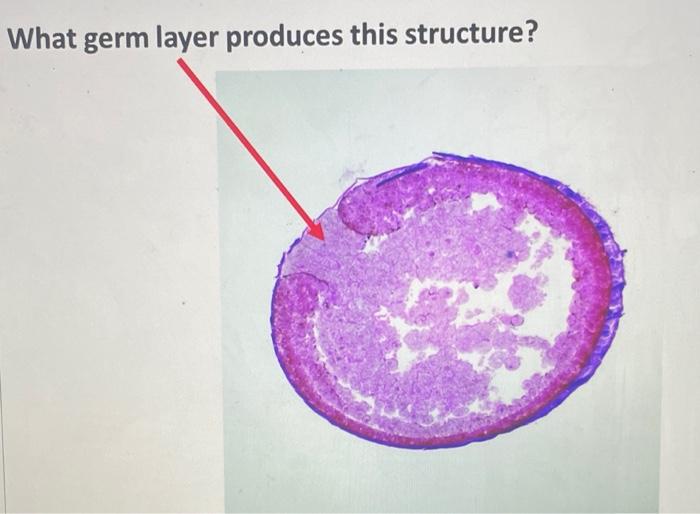 Solved Identify the germ layer that creates the structures | Chegg.com