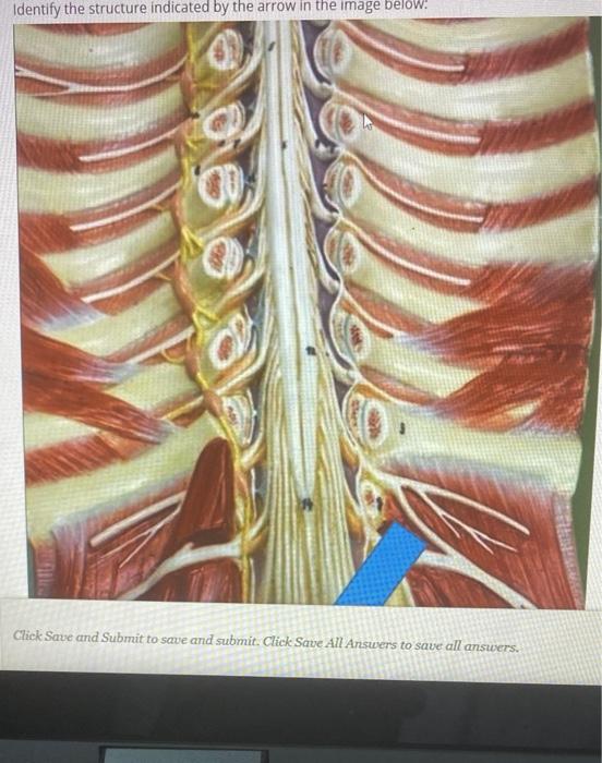 Solved Identify the structure indicated by the arrow in the | Chegg.com