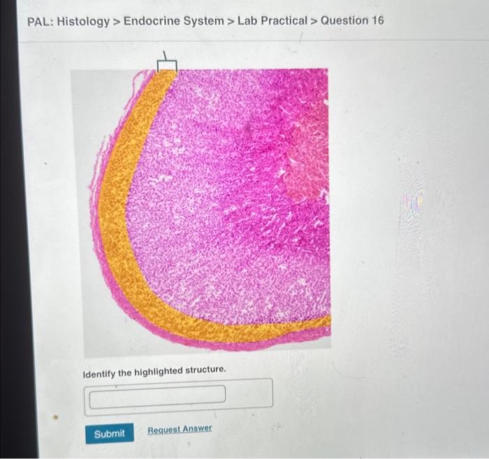 Solved PAL: Histology > Endocrine System > Lab Practical > | Chegg.com