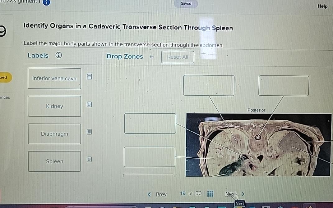 Identify Organs in a Cadaveric Transverse Section | Chegg.com