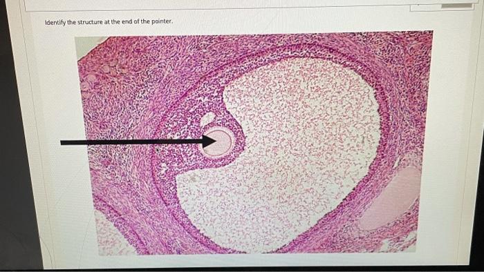 Solved Identify the structure at the end of the pointer | Chegg.com
