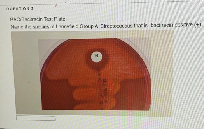 Solved QUESTION 2 BAC/Bacitracin Test Plate: Name the | Chegg.com