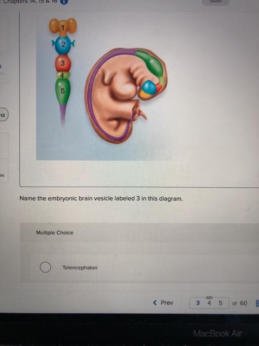 Solved S 2x 12 Name the embryonic brain vesicle labeled 3 in | Chegg.com