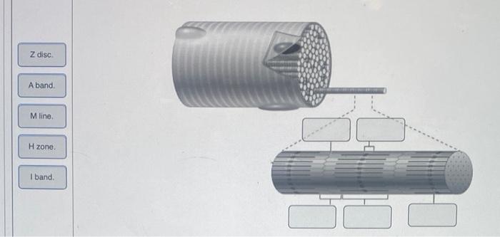 Solved Z disc A band M line H zone. I band. | Chegg.com