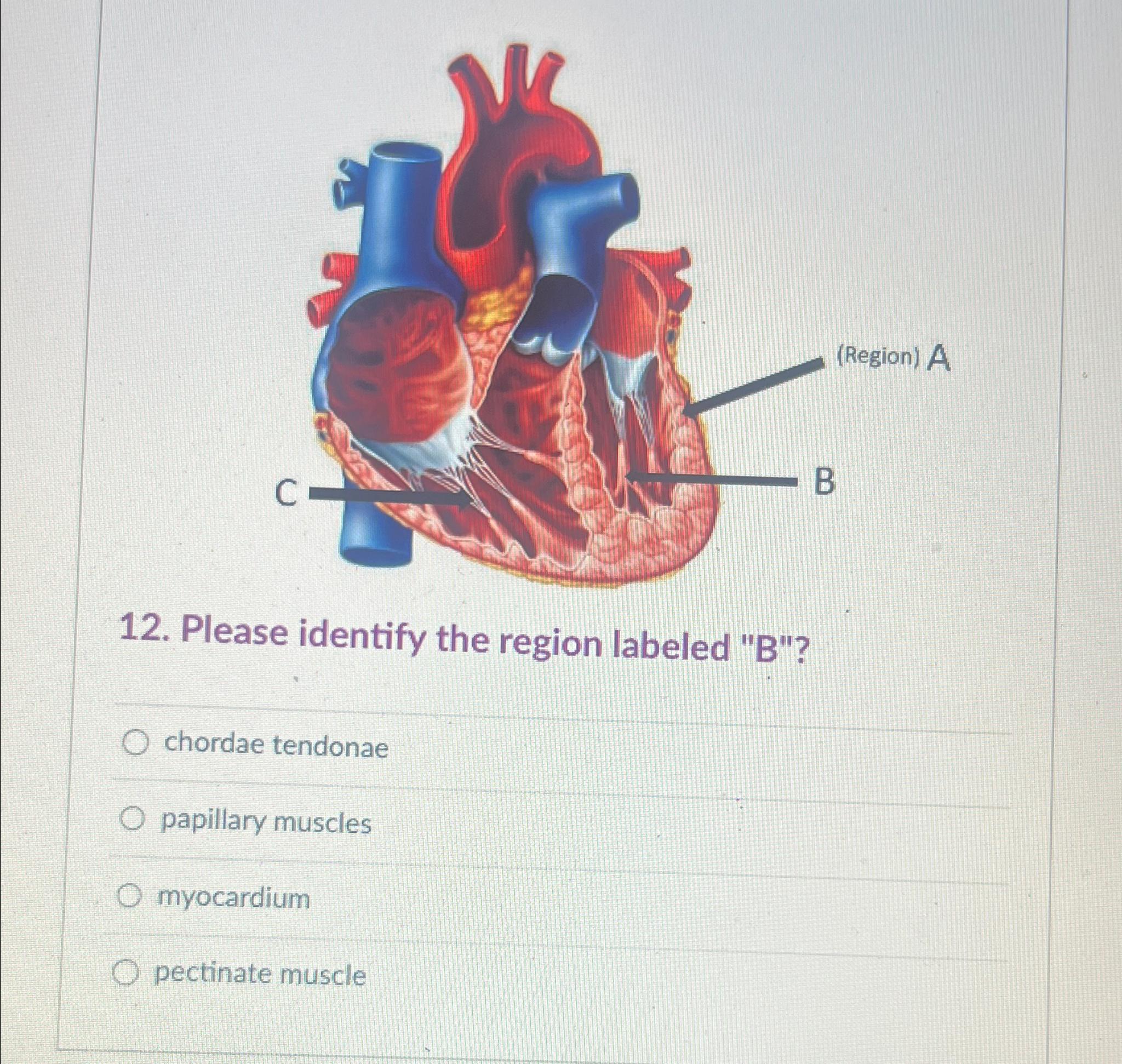 Solved Please identify the region labeled "B"?chordae | Chegg.com
