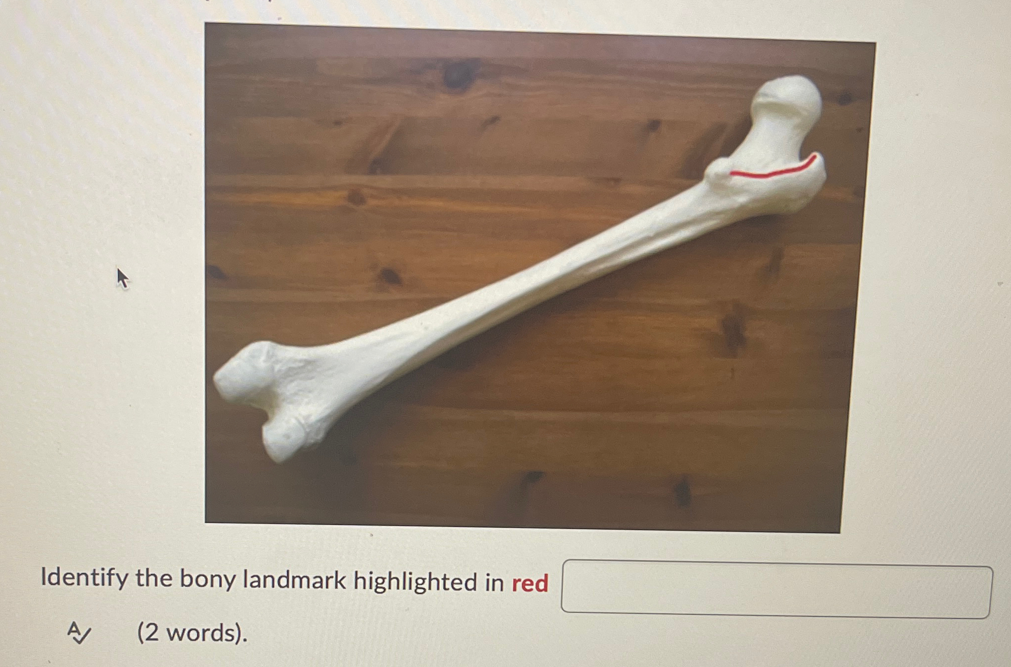 Solved Identify the bony landmark highlighted in redA) (2 | Chegg.com