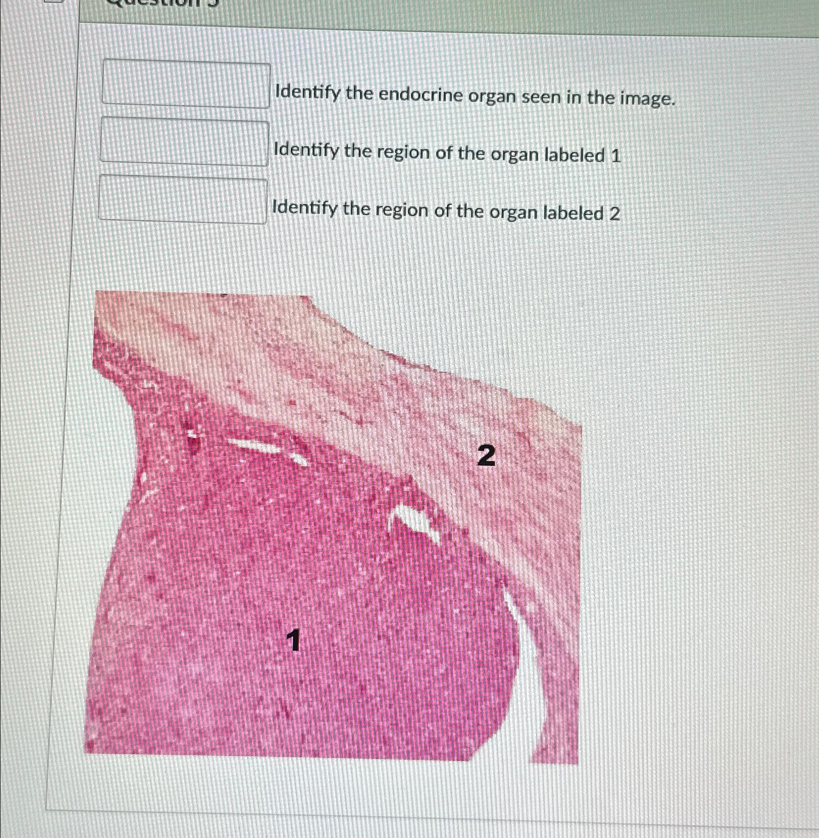 Solved Identify the endocrine organ seen in the | Chegg.com