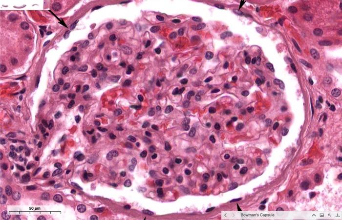 Solved Simple squamous Epithelium. please label the apical | Chegg.com