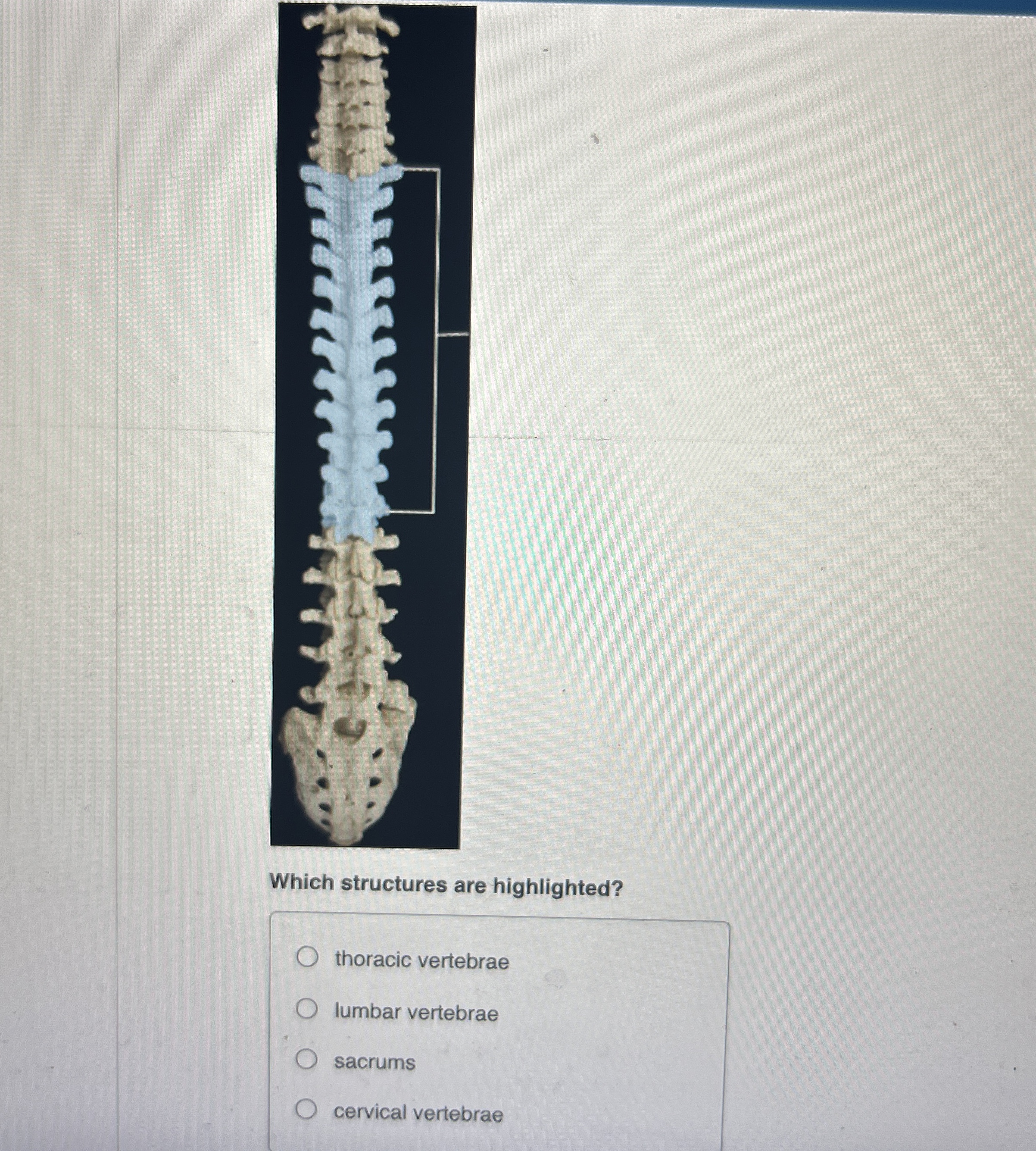 Solved Which structures are highlighted?thoracic | Chegg.com