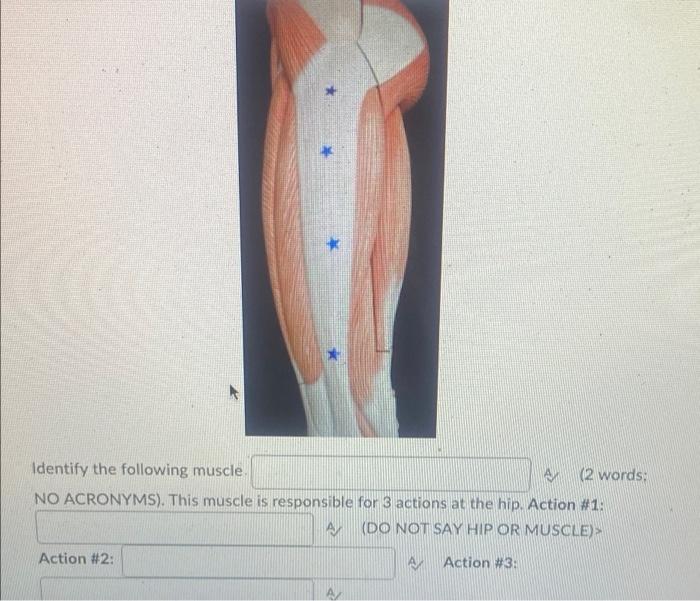 Solved Identify the following muscle. A (2 words: NO | Chegg.com