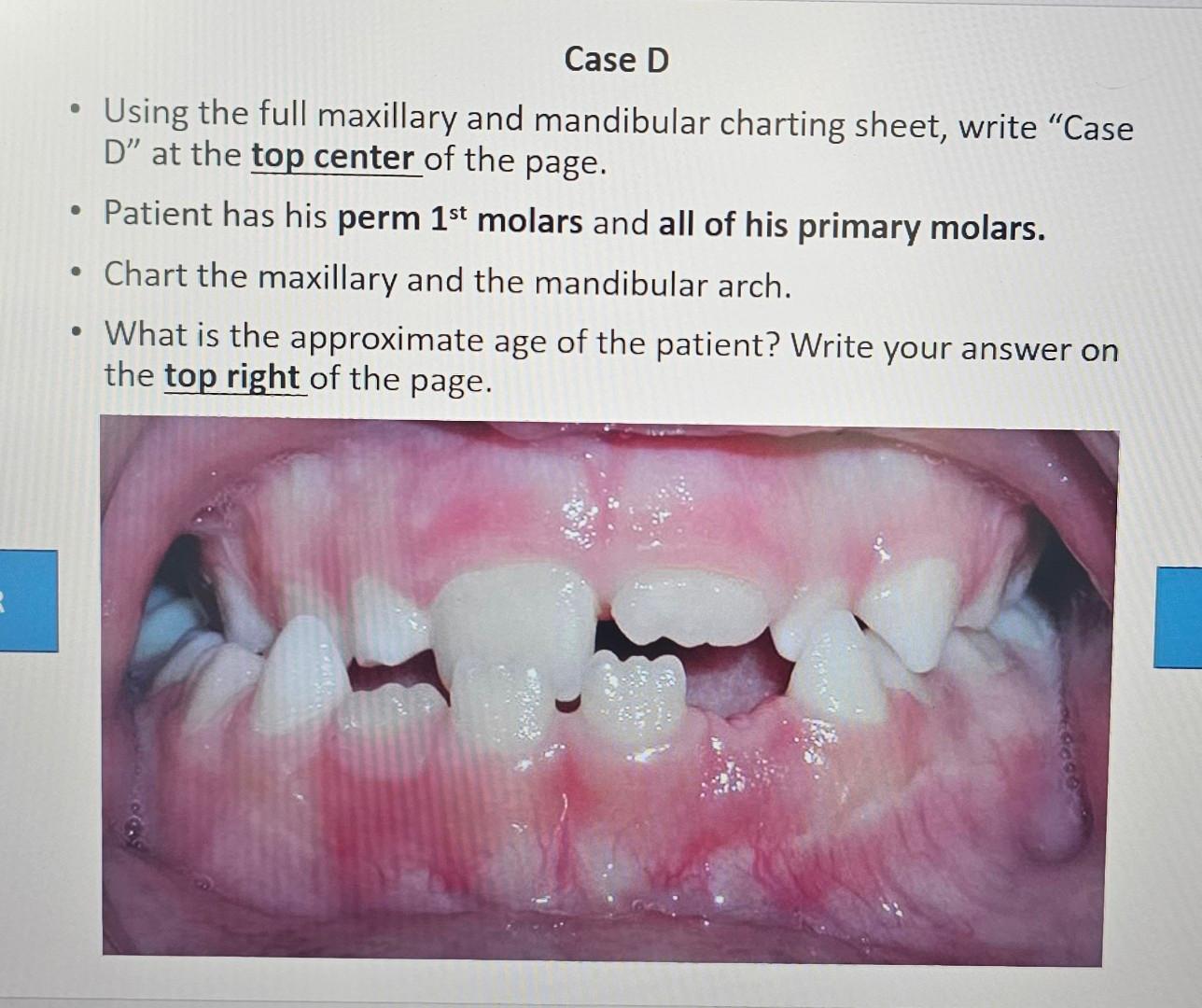 Solved Please help me chart: using the full maxillary and | Chegg.com