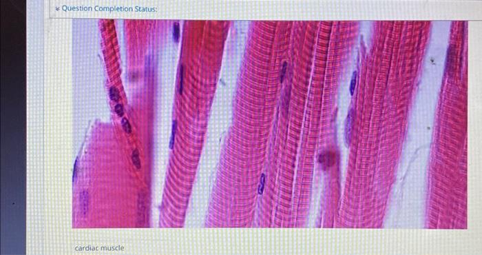 Solved 1.identify the type of muscle found within this | Chegg.com Solved 1.identify the type of muscle found within this | Chegg.com