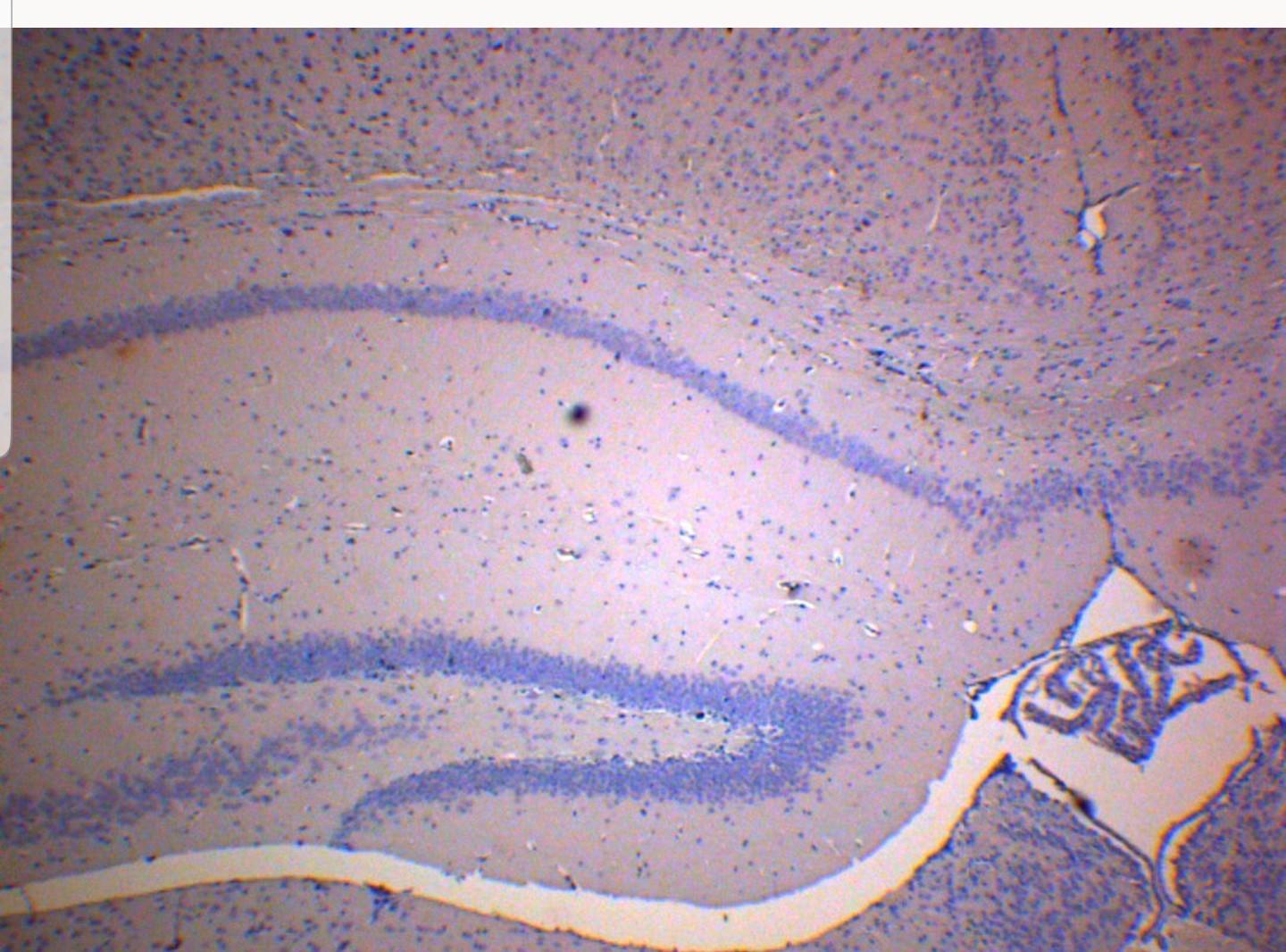 Solved discuss and interpret the stains sample of brain | Chegg.com