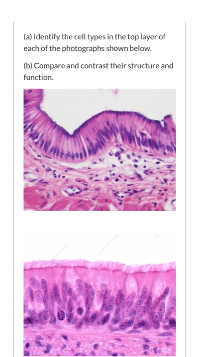 Solved (a) Identify the cell types in the top layer of each | Chegg.com