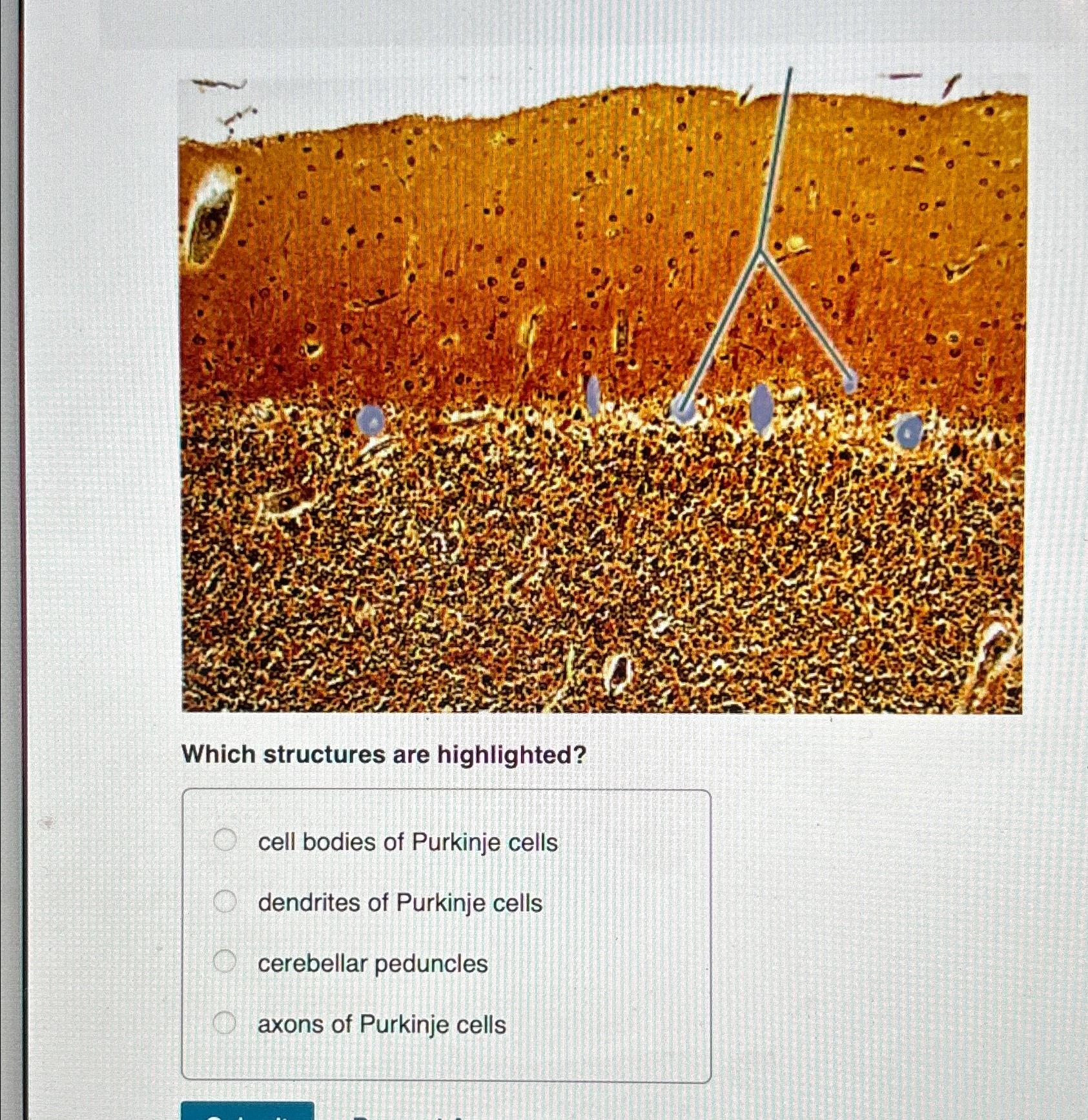 Solved Which structures are highlighted?cell bodies of | Chegg.com