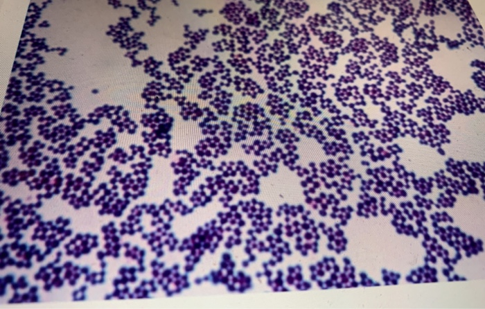 Solved Bacillus trod shaped) Coccus Gram Positive | Chegg.com