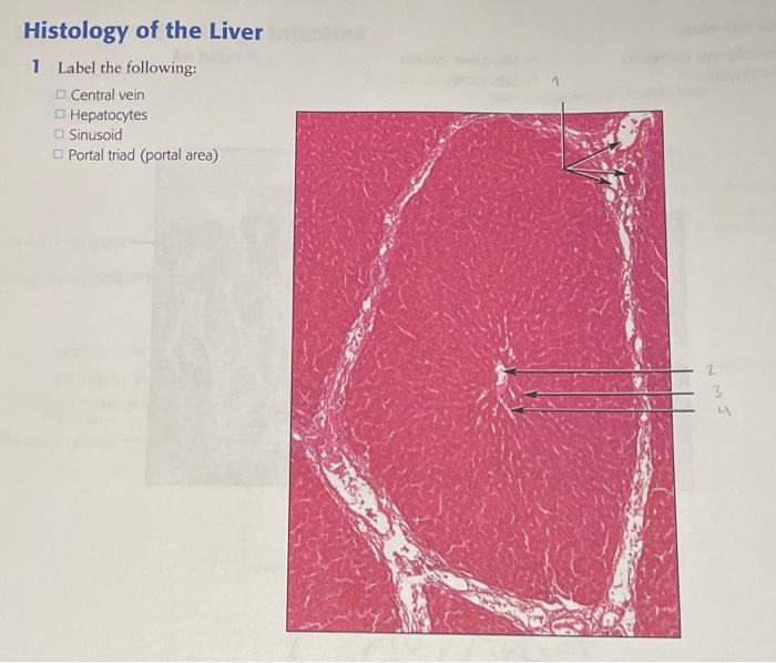 Solved Histology of the Liver 1 Label the following: Central | Chegg.com